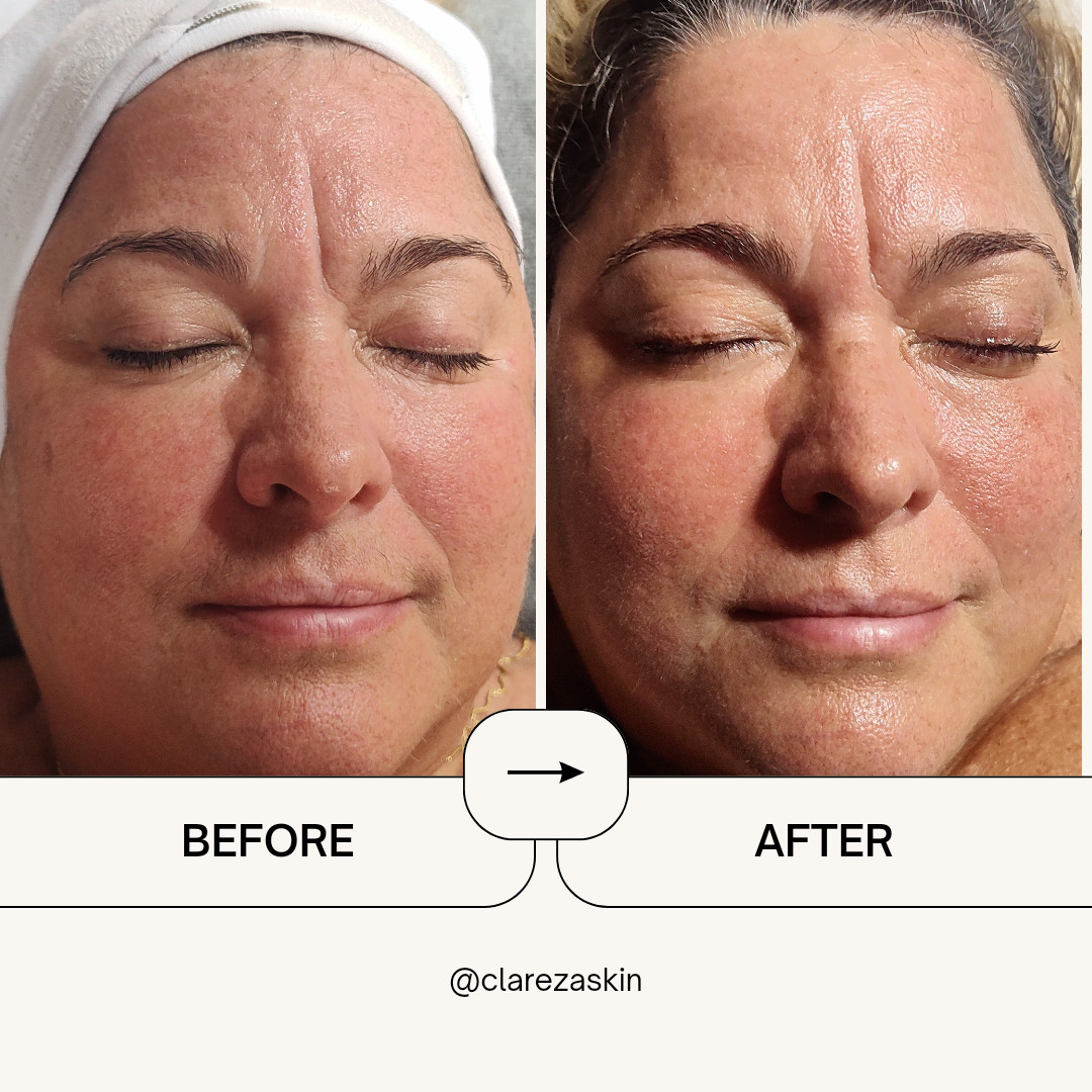 Relaxing Facial & Head Spa - Clareza Skin